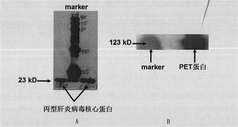 Nucleic Acid Aptamer Specifically Combined With Hepatitis C Virus Core