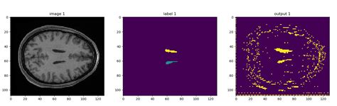 Segmentation Example On Multiple Labels · Issue 415 · Project Monai