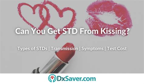 can you get std from kissing std transmission symptoms testing