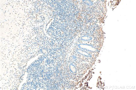 Cd24 Antibody 10600 1 Pbs Proteintech