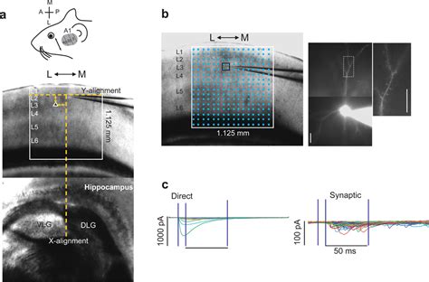 The Functional Asymmetry Of Auditory Cortex Is Reflected In The