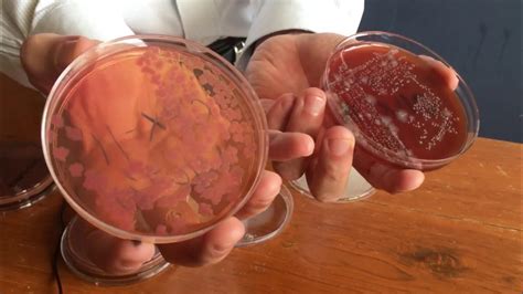 Cultivos En Microbiología Clínica Dr Alejandro Macias Youtube