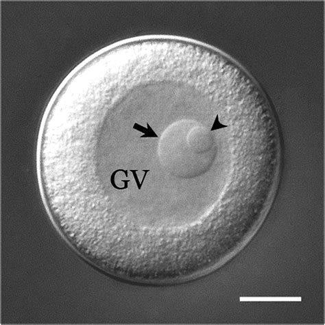 【germinalvesicle】什么意思英语germinalvesicle的翻译音标读音用法例句在线翻译有道词典