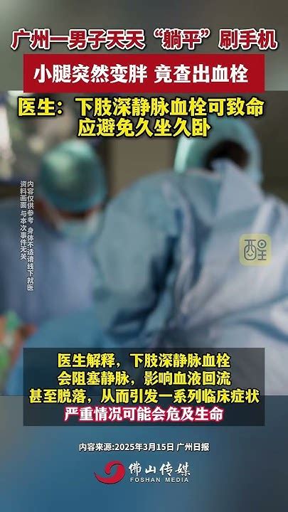 廣州一男子天天“躺平”刷手機，小腿突然變胖 竟查出血栓 ，醫生：下肢深靜脈血栓可致命 ，應避免久坐久臥 廣州 健康 習慣 科普 注意