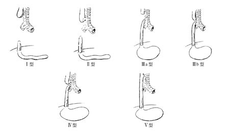 三、病理分型 儿科学 医学