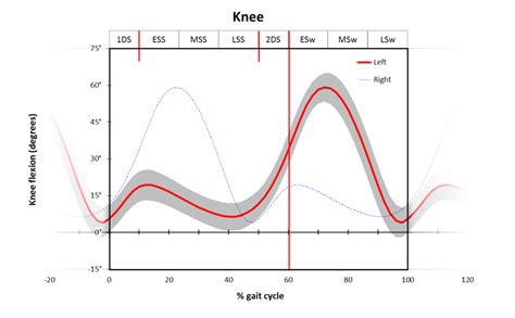 Gait Graphs Walking With Richard