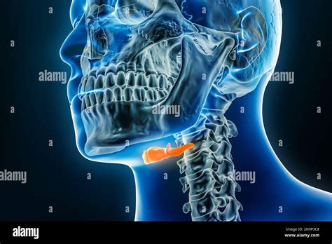 Hyoid Bone X Ray Approach To Lateral Neck Radiographs Radiology Key
