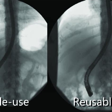 Single Use And Reusable Duodenoscopes In Short Ercp Position For
