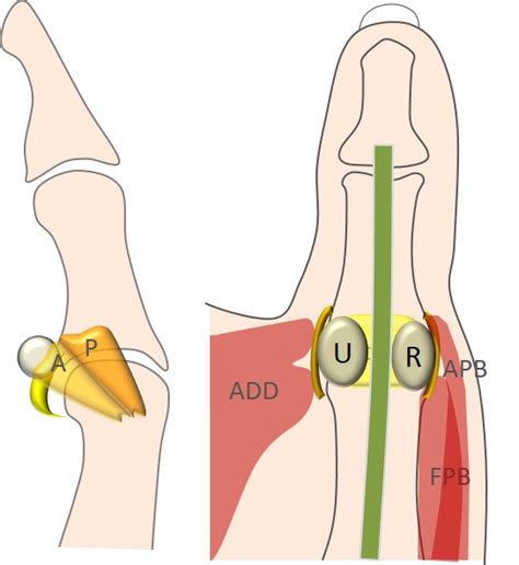 [손가락] 엄지 손가락 Sesamoiditis 종자골염 Ip통증 엄지trigger Finger시 동반 또는 감별이 필요 네이버 블로그