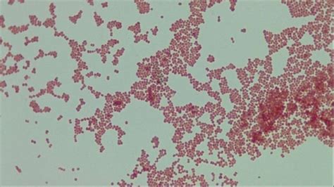 Solved Gram Strain Report The Gram Reaction Describe The