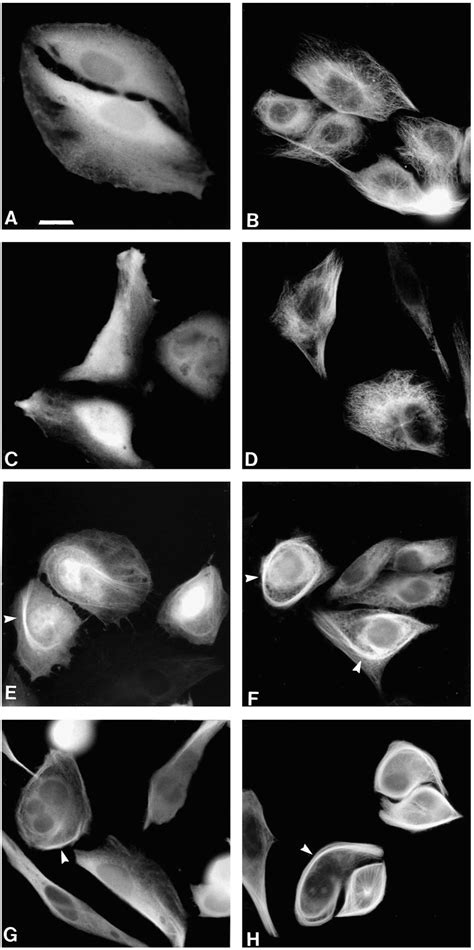 Microtubule Binding And Rearrangement By Carboxyl Terminal Sequence Download Scientific Diagram