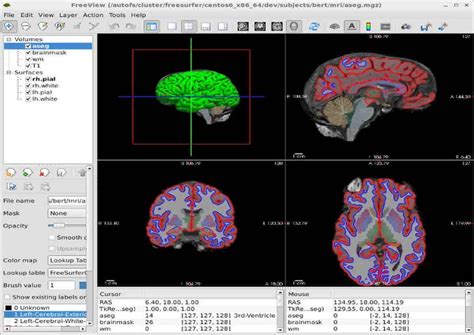 brain mri scan 3d