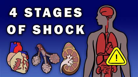 The 4 Stages Of Shock Youtube
