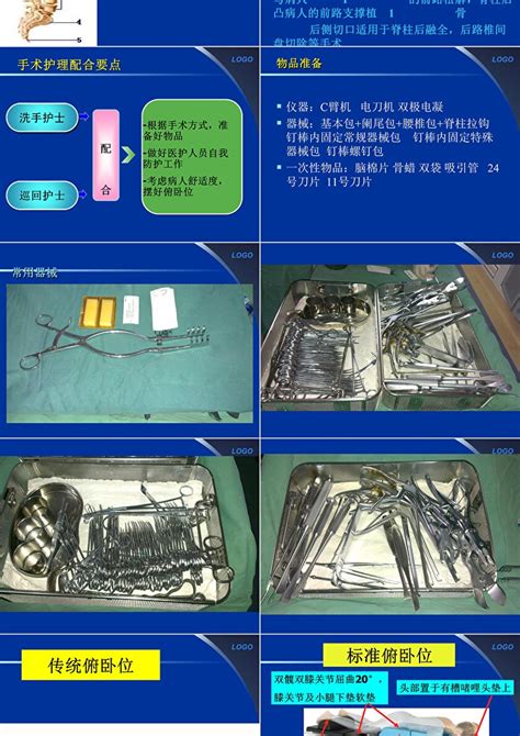 腰椎钉棒内固定术手术配合ppt模板卡卡办公