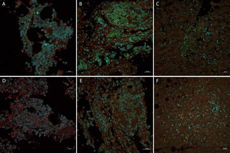 Invitrogen Goat Anti Mouse Igg Hl Highly Cross Adsorbed Secondary