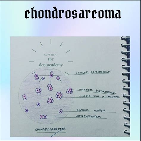 Chondrosarcoma Dental Hygiene School Oral Pathology Pathology