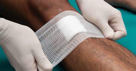 Cuidado De Heridas Abiertas Tipos Riesgos Y Tratamiento Salud Tudo