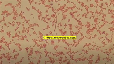 Enterobacter Introduction Morphology Pathogenicity Lab Diagnosis