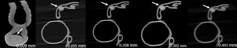 Two Dimensional Micro Computed Tomography Micro Ct 0009 Mm Slice