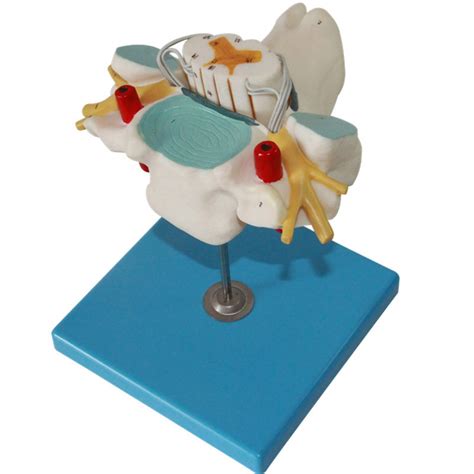 Buy Blld Cervical Spine Model Spinal Cord Cervical Spinal Nerve