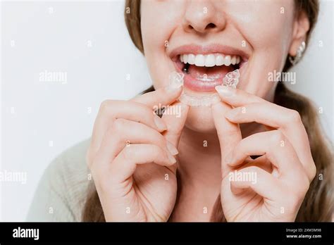 Smiling Woman With A Snow White Smile Demonstrate Clear Teeth Aligner