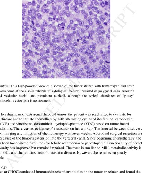 Single Column Title Surgical Specimen Demonstrating A Download