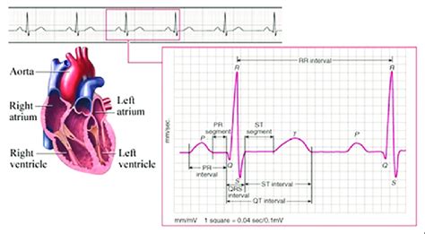representation of electrocardiograph signals download scientific diagram