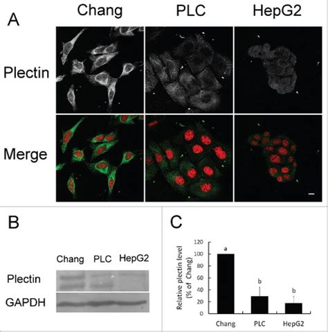 Full Article Plectin Deficiency In Liver Cancer Cells Promotes Cell