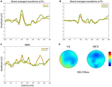 Frontiers The Accuracy Of Different Mismatch Negativity Amplitude Representations In