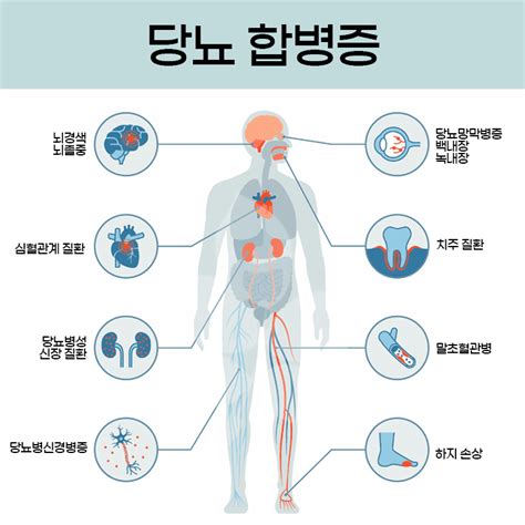 당뇨 합병증 예방 전략 1 눈 신장 발 건강 유지법 펩한 페이퍼