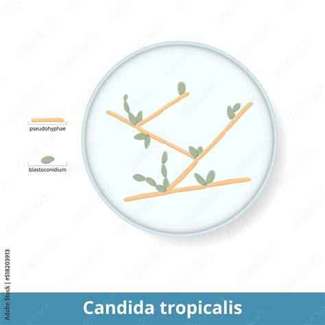 Candida Tropicalis Species Of Yeast In The Genus Candida A Common