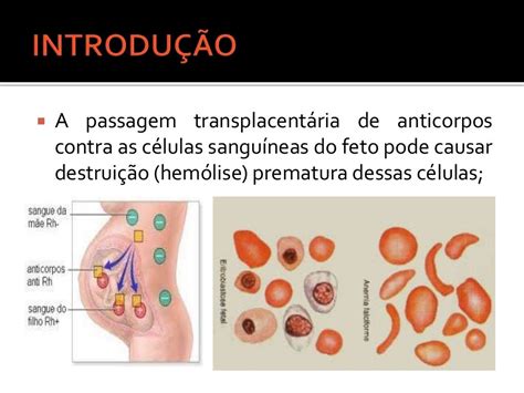 Apresentacao Eritroblastose Fetal