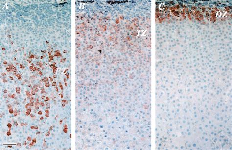 Zonal Expression Of B5 P450c17 And 3hsd In Fetal Macaque Adrenal