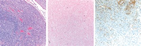 Histopathology Left Hematoxylin And Eosin Stained Tissue Download Scientific Diagram