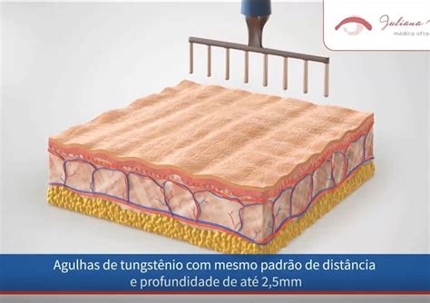 Blog Página 5 Dra Juliana Medrado Médica Oftalmologista