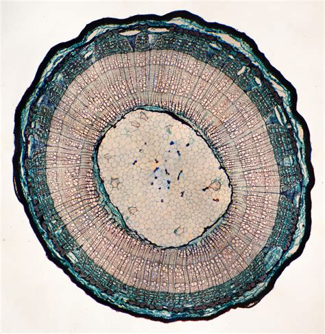 Xylem Cross Section