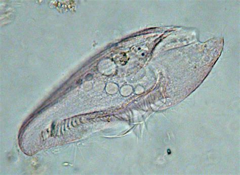 Stefansbachtal Gevelsberg Leben Im Teich Das Rote Lidtierchen Blepharisma Sp Heterotrichida