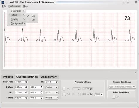 Ecg Simulator Calibration At Marjorie Lockett Blog