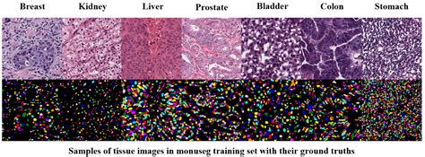 Github Amin Sjnuclei Segmentation Nuclei Segmentation Using Deep Learning