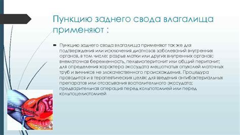 Презентация тема Пункция заднего свода Пункция заднего
