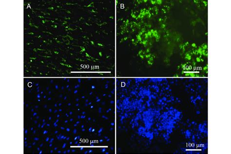 α Fetoprotein Staining By Icc Expression Of This Marker Was Visible On