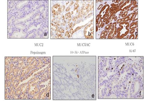 Immunohistochemical Examination Download Scientific Diagram