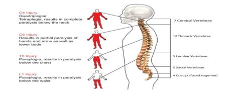 Traumatic Spine Injury 7scope Ortho Care