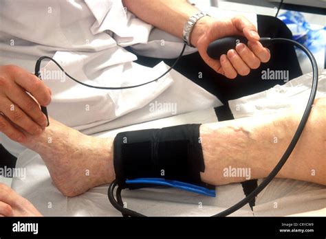 How To Perform Ankle Brachial Index
