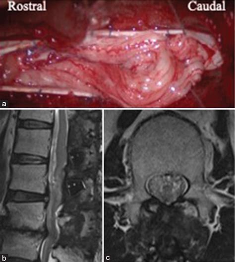 Surgical Neurology International