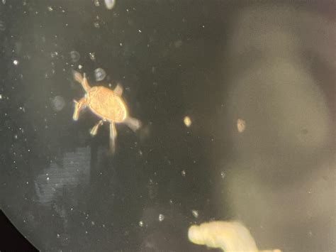 Pitcher Plant Fluid Bug Rmicrobiology