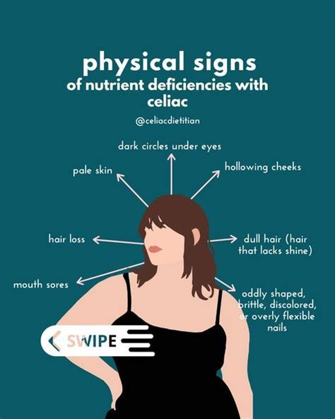 Polycystic Ovary Syndrome Pcos Artofit