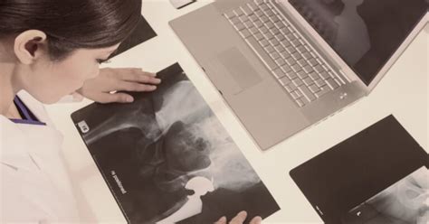 Stryker Hip Replacements Alexander Shunnarah Trial Attorneys