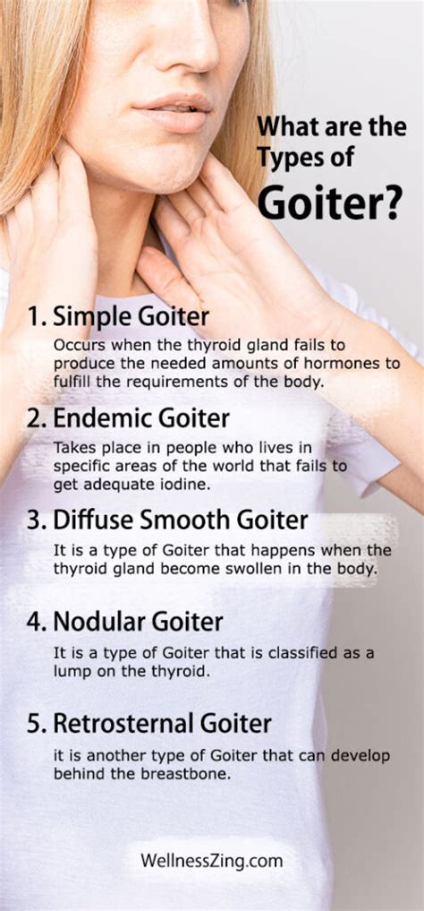 Types Of Goiter WellnessZing