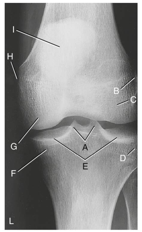 Knee Joint Labeling Diagram Quizlet